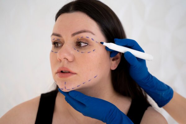 Fat Grafting with Under-Eye Fat Repositioning in Korea | Cost, Types ...
