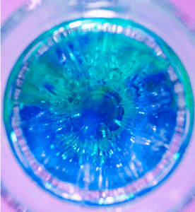 LENTIS Mplus X Toric IOL in korea| Cost, Types, Doctors & Best Seoul ...